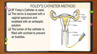 HYSTEROSALPHINGOGRAPHY - Radiology :1st Year Anatomy. | PPTX