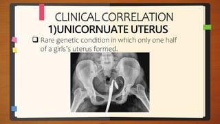 HYSTEROSALPHINGOGRAPHY - Radiology :1st Year Anatomy. | PPTX