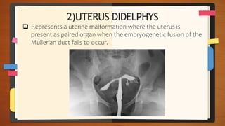 HYSTEROSALPHINGOGRAPHY - Radiology :1st Year Anatomy. | PPTX