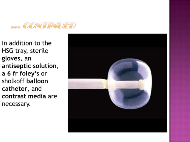 Hysterosalpingography | PPTX | Pregnancy | Reproductive Health