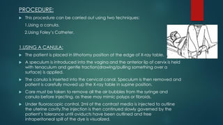 Hysterosalpingography.pdf