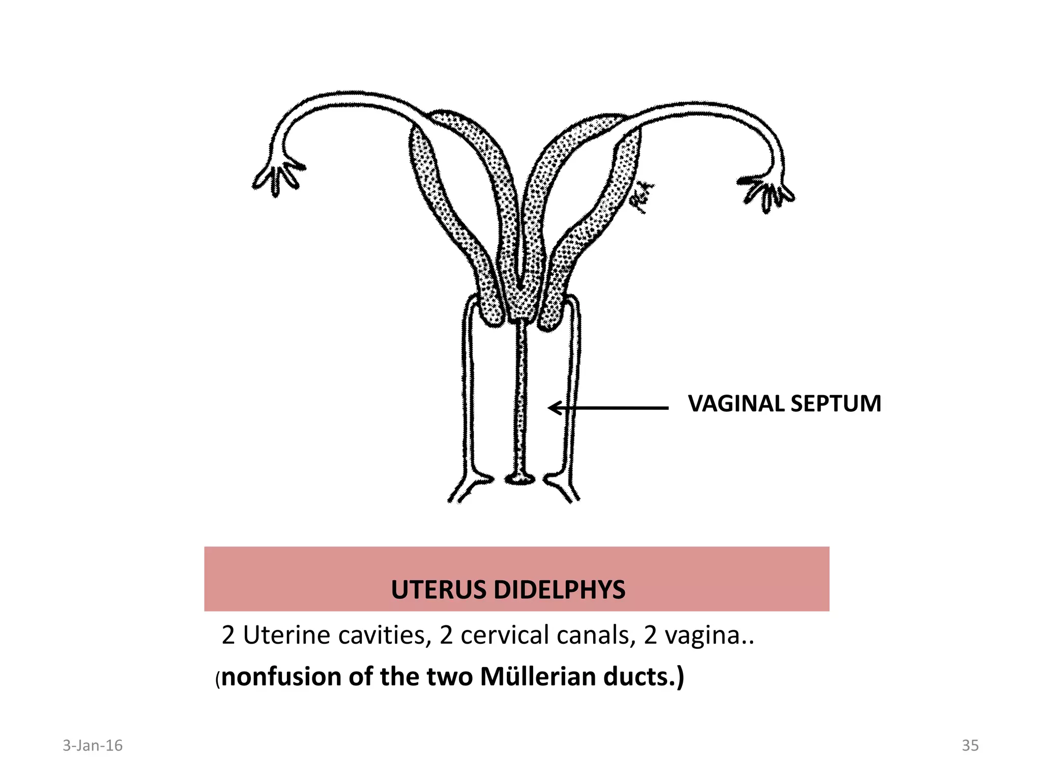 Hysterosalpingography | PPTX