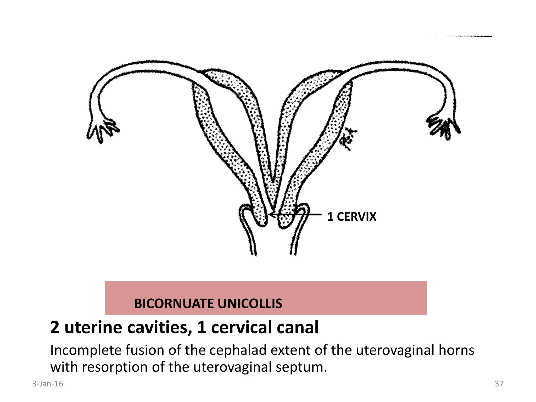 Hysterosalpingography | PPTX