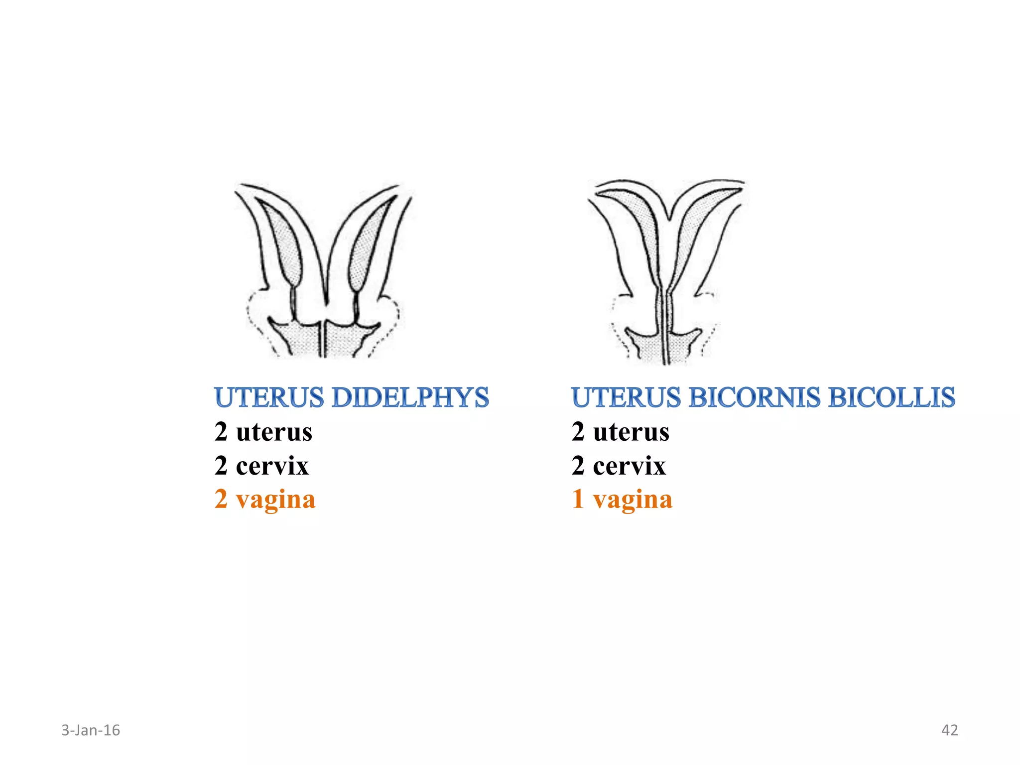 Hysterosalpingography | PPTX