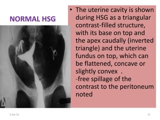 Hysterosalpingography | PPTX