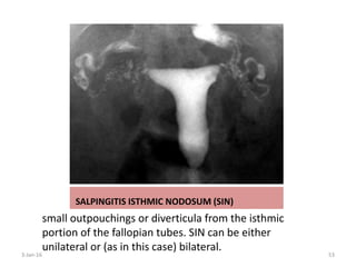 Hysterosalpingography | PPTX