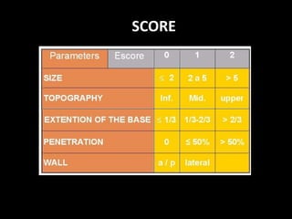 Hysteroscopic classification of submucous fibroids | PPTX