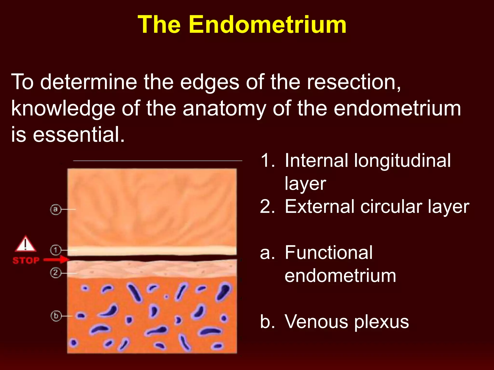 Hysteroscopic endometial resection | PDF