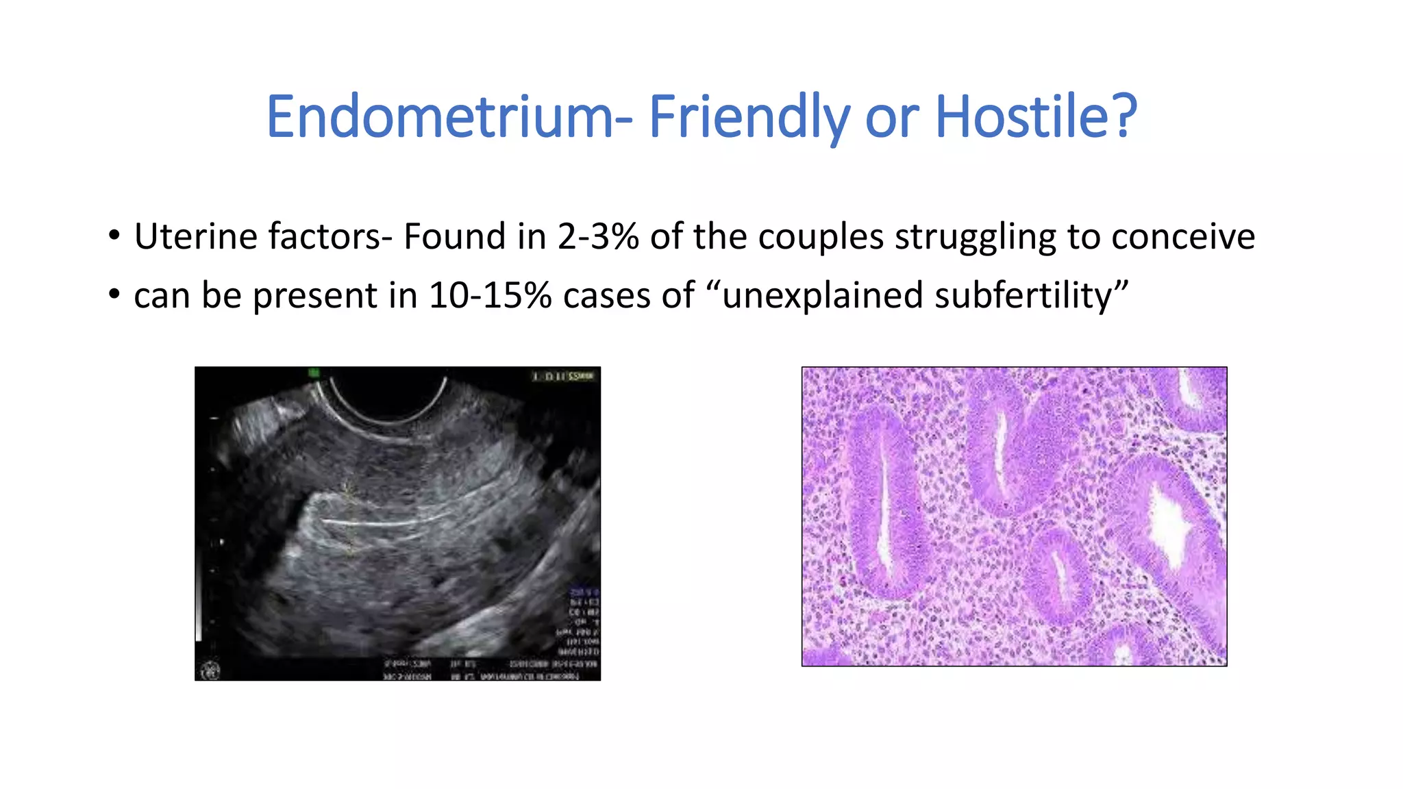 Indications of Hysteroscopy | PPTX