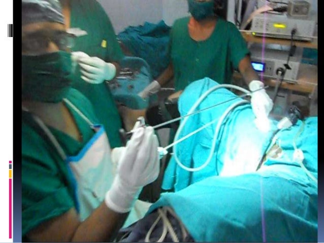 Hysteroscopy