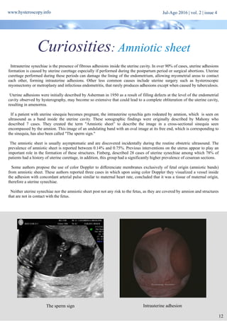 Hysteroscopy newsletter vol2 issue 4 english | PDF