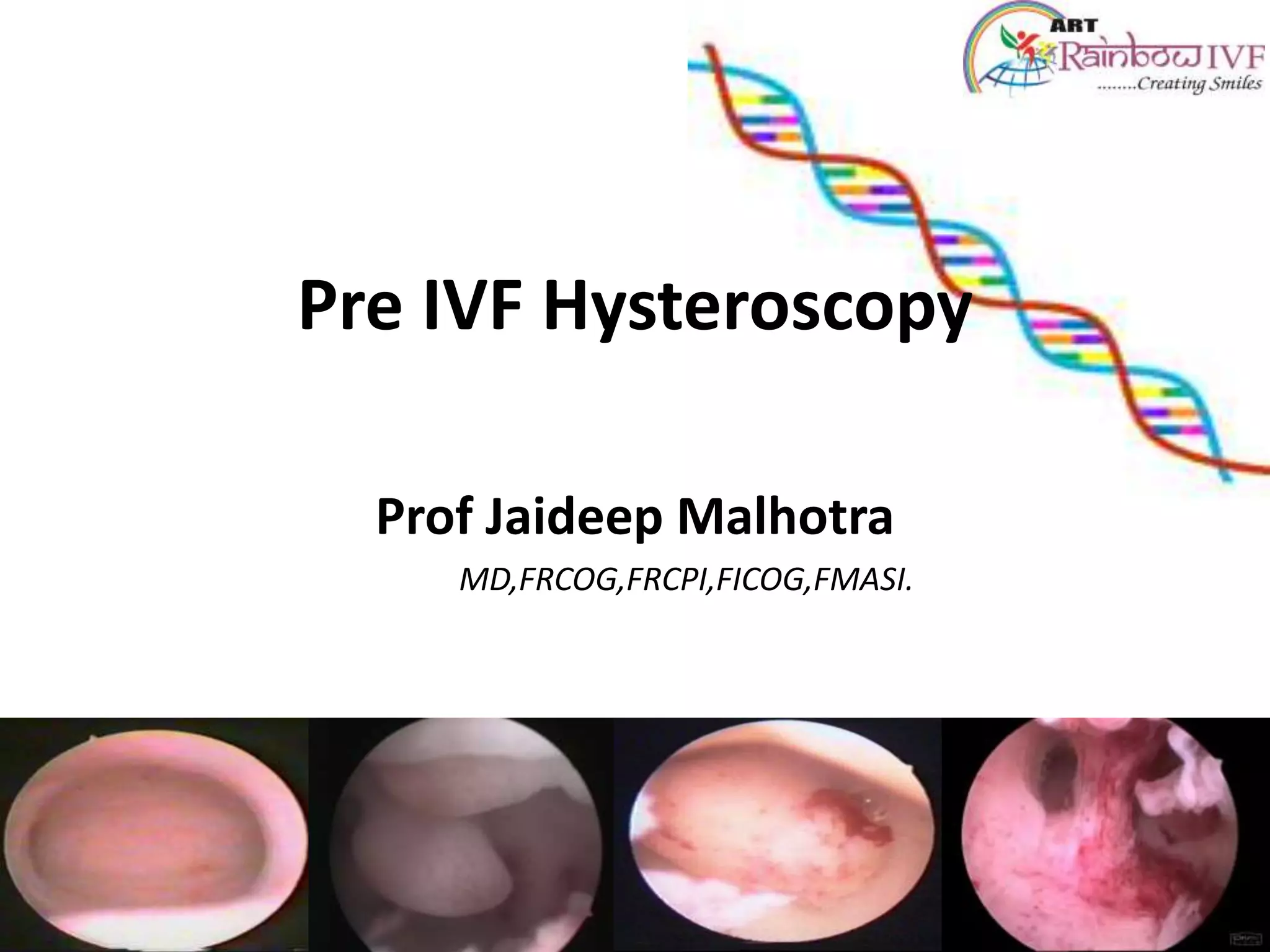Hysteroscopy pre IVF is it neccessary ?? | PPTX