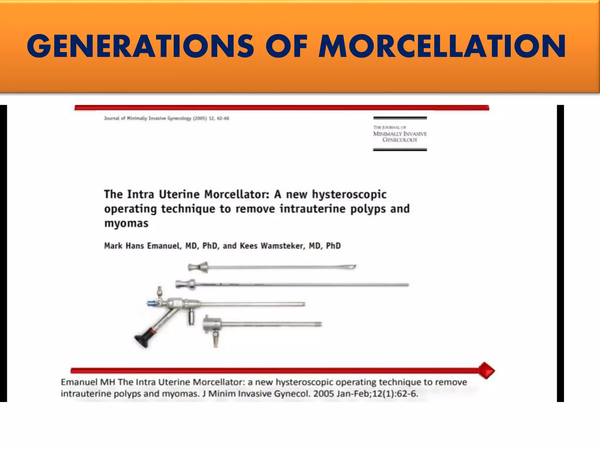 Hystroscopic morcellation..waled ayad | PPT
