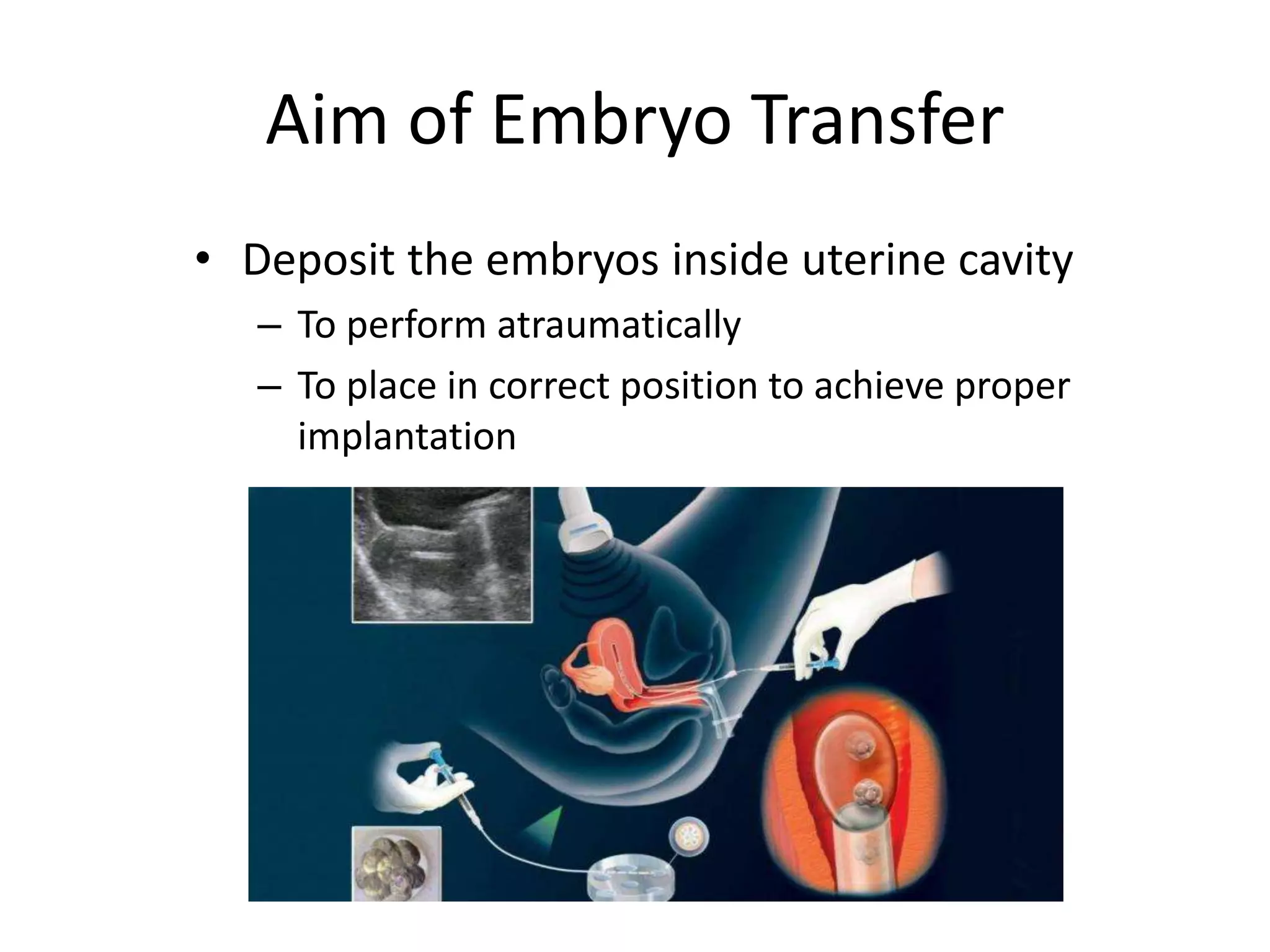 Role of Hysteroscopy in Difficult Embryo Transfers | PPTX