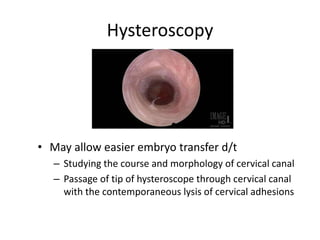 Role of Hysteroscopy in Difficult Embryo Transfers | PPTX