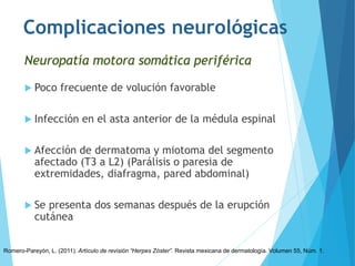 Herpes zoster | PPTX