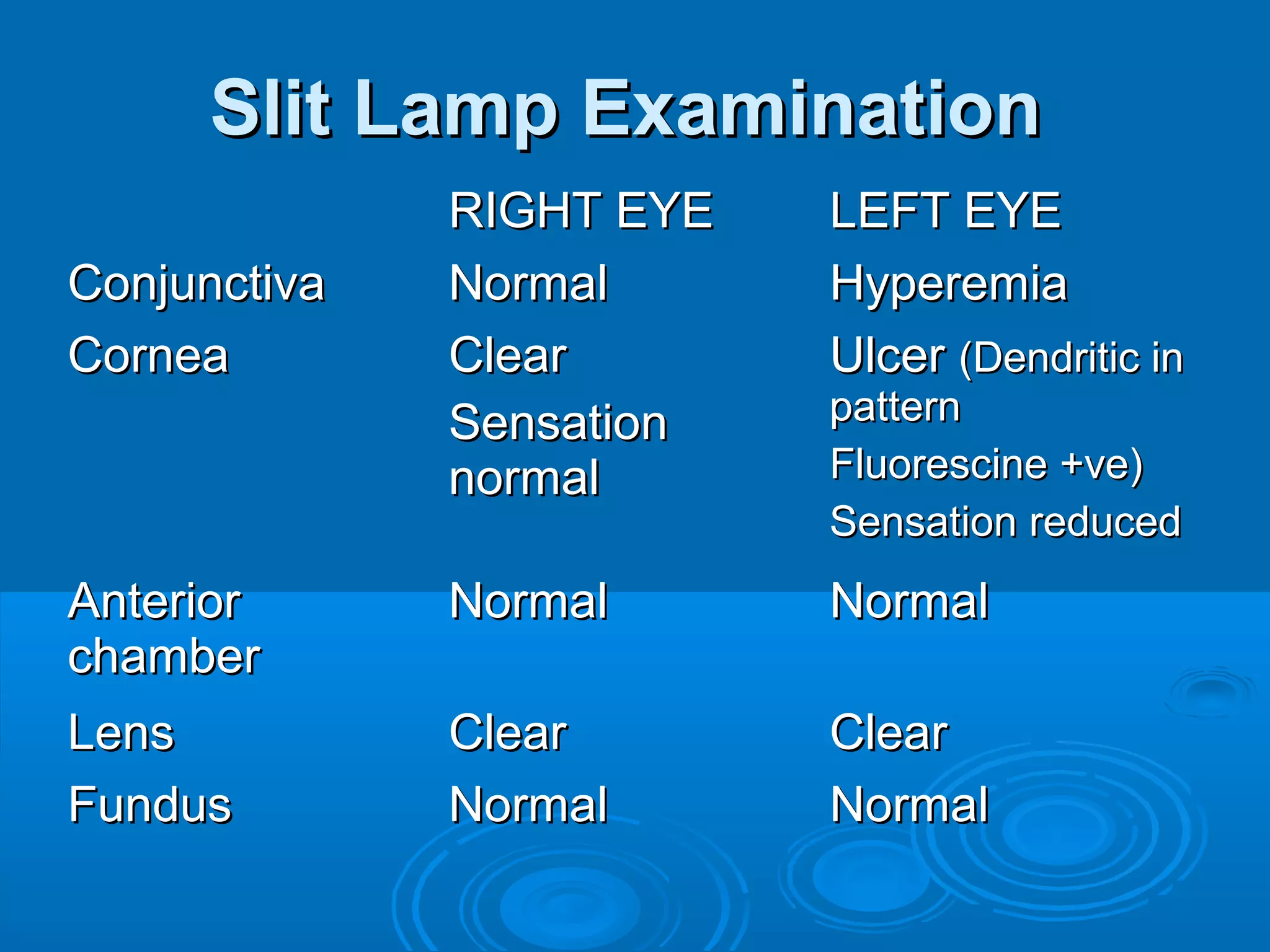 Herpes zoster ophthalmicus | PPT