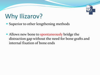 Ilizarov technique - The answer for non union | PPTX
