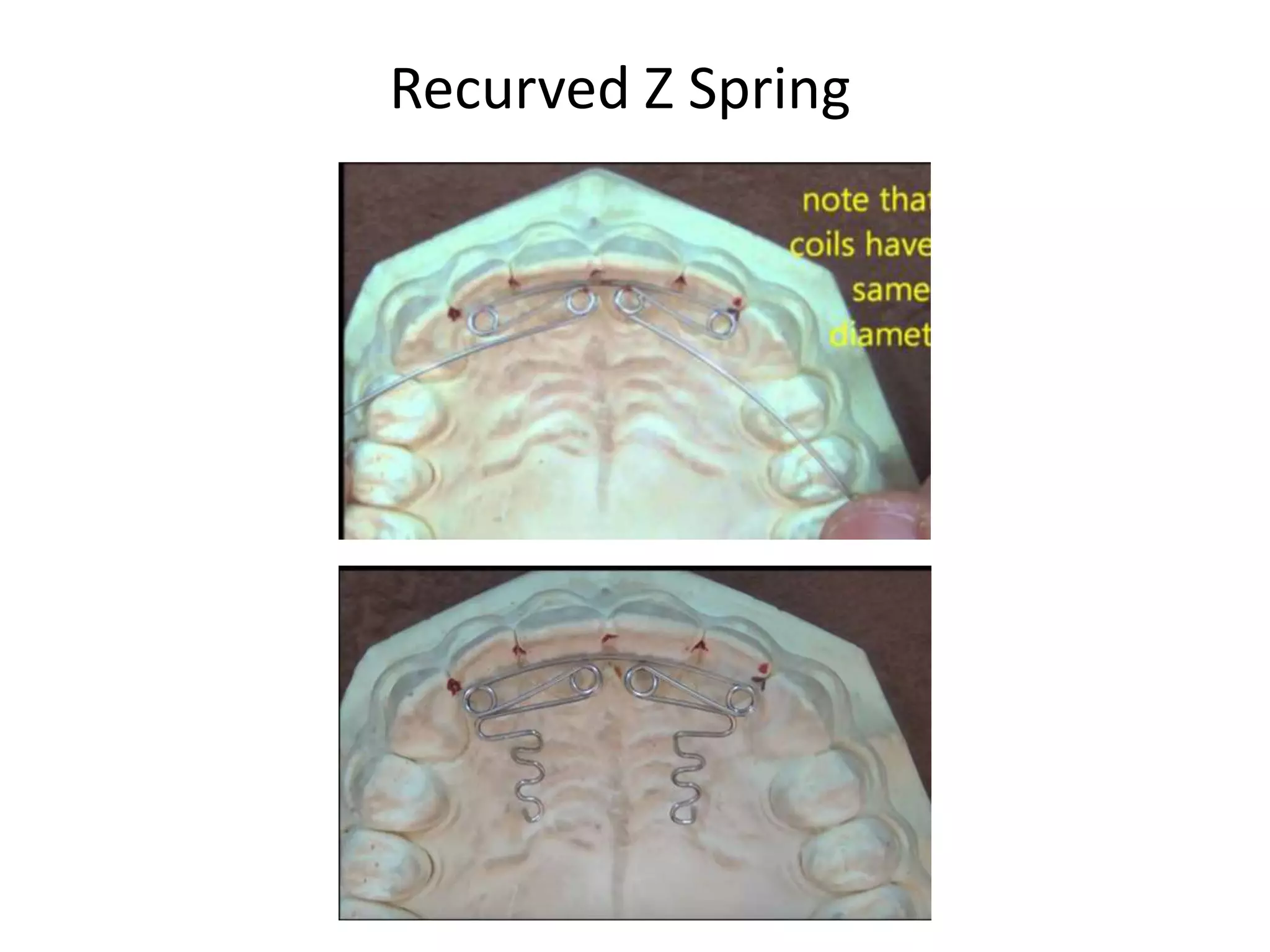 Orthodontics I | PPT