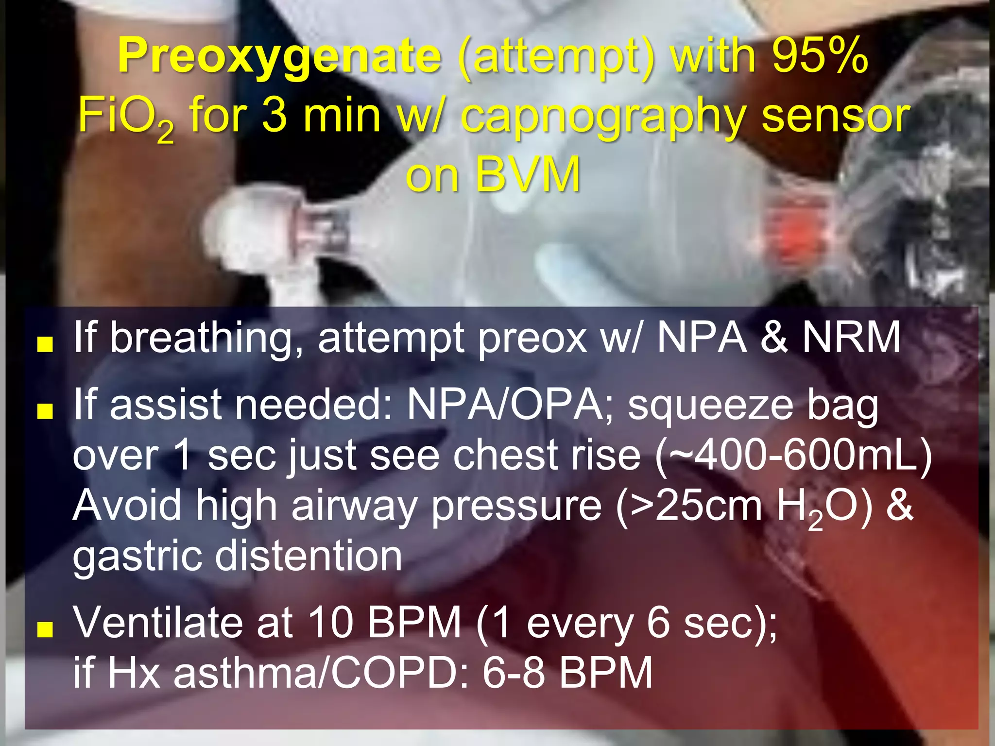 I Gel Training | PDF