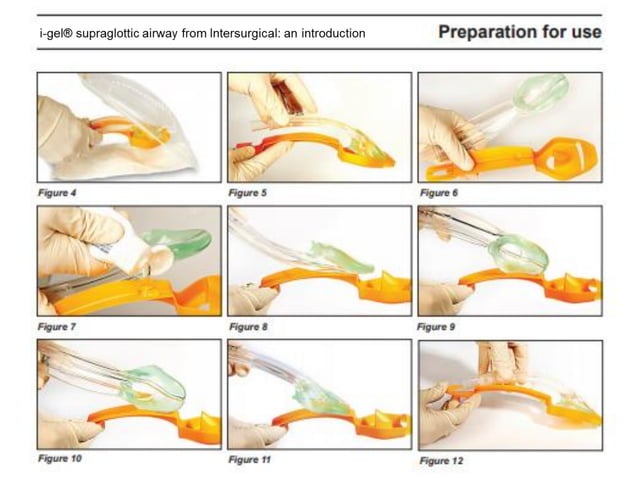 I Gel Training | PDF