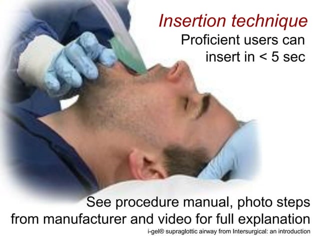 I Gel Training | PDF