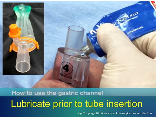 I Gel Training | PDF