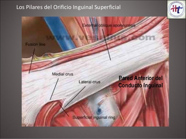 I hernia inguinal htca 2016 (2)