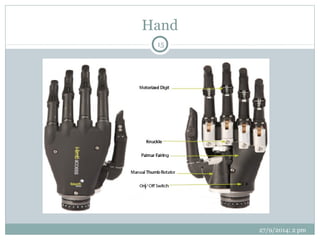 I limb hand | PPT
