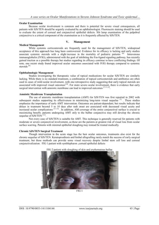 A case series on Ocular Manifestations in Stevens Johnson Syndrome and ...