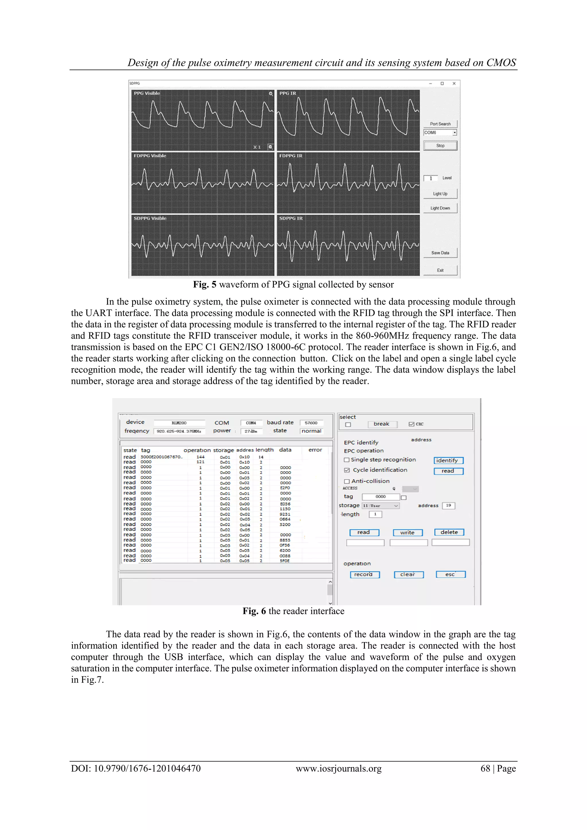 Design of the Pulse Oximetry Measurement Circuit and Its Sensing System ...