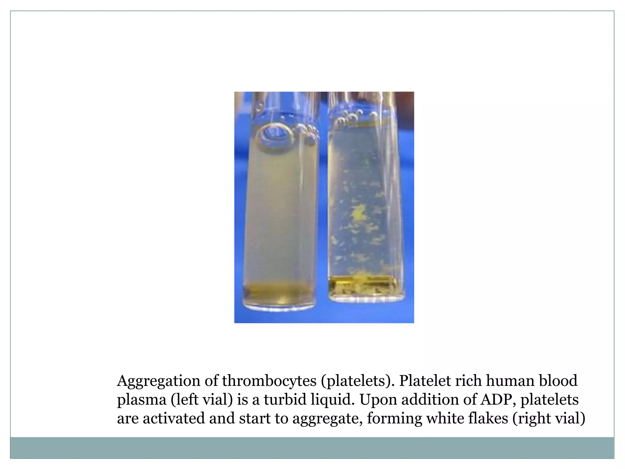 Glanzmann thrombasthenia | PPTX