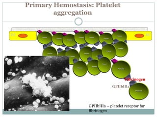 Glanzmann thrombasthenia | PPTX