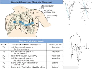 ECG Leads | PPTX