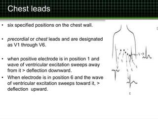 ECG Leads | PPTX