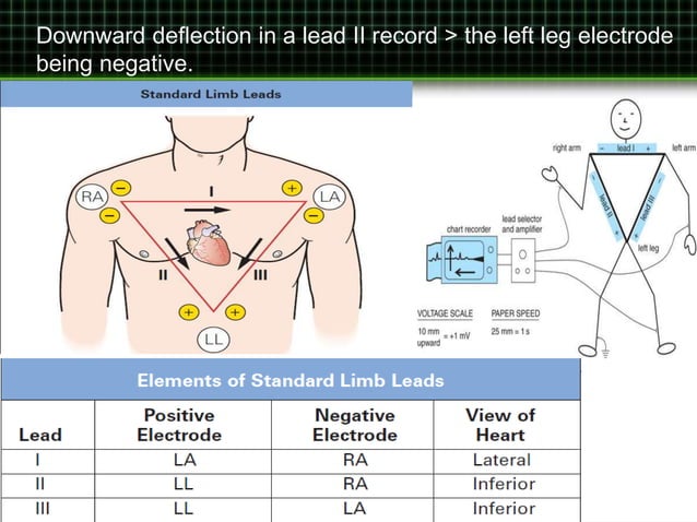 ECG Leads | PPTX | Heart and Cardiovascular Diseases | Diseases and ...