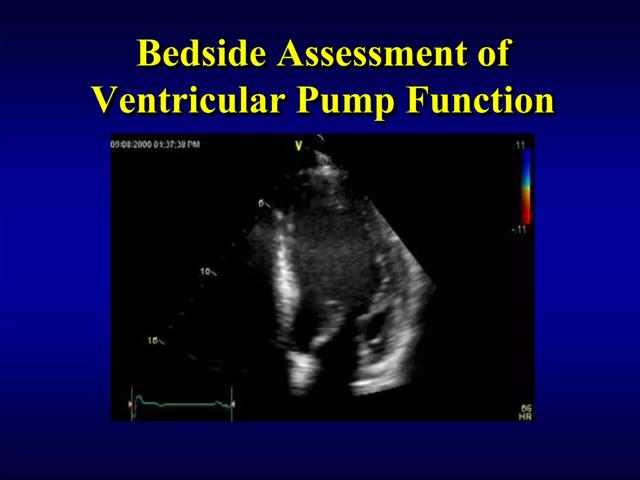 Pathophysiology of acute heart failure in ICU by Professor Michael ...