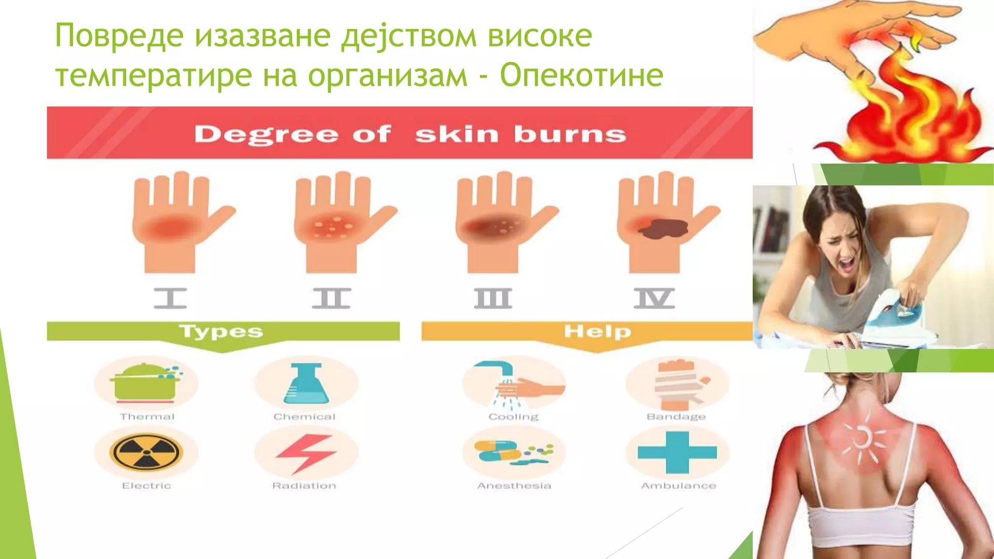 Zdravstvena zastita sa prvom pomoci-opekotine | PPTX
