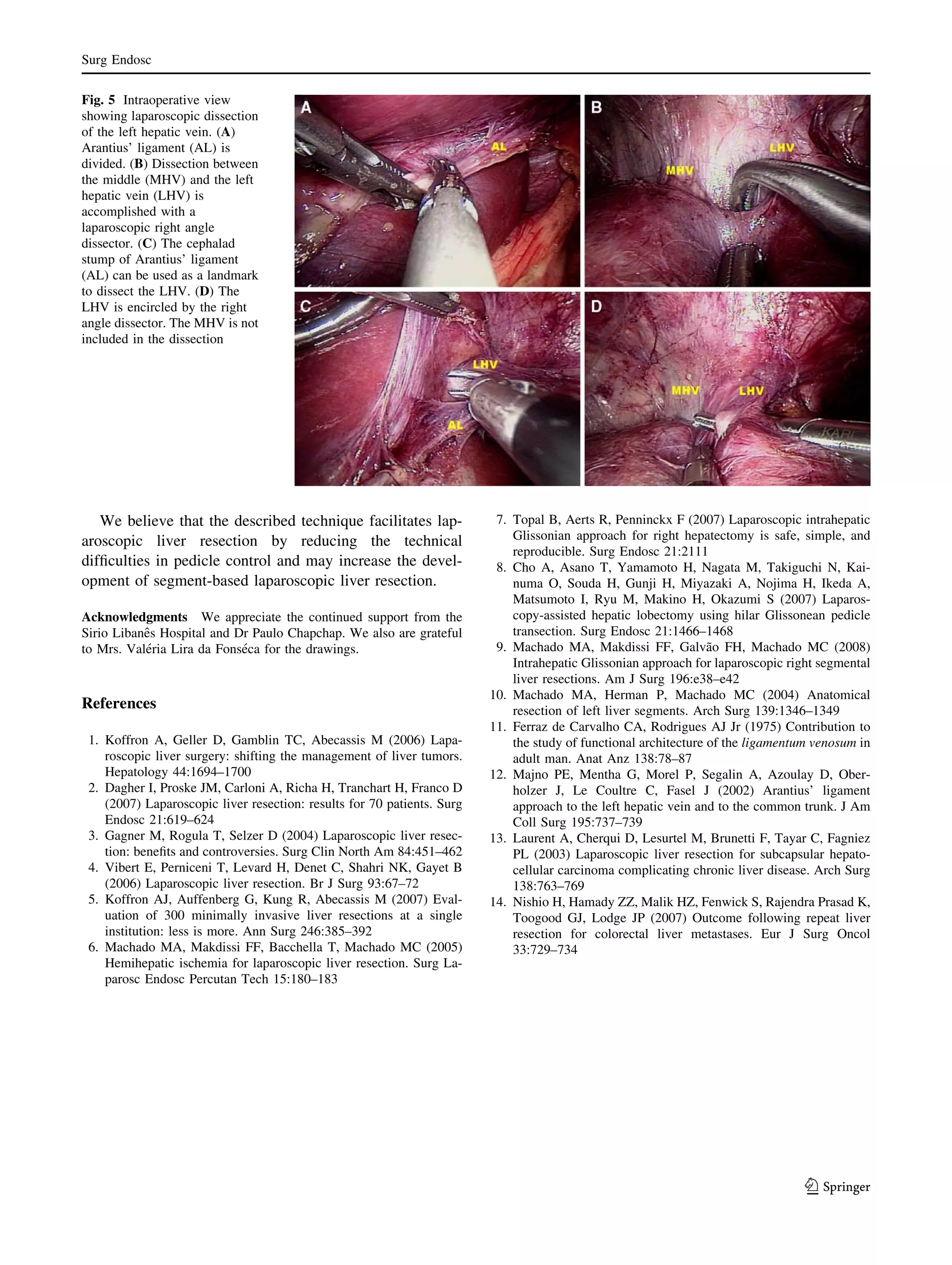 Laparoscopic intrahepatic Glissonian technique for liver surgery ...