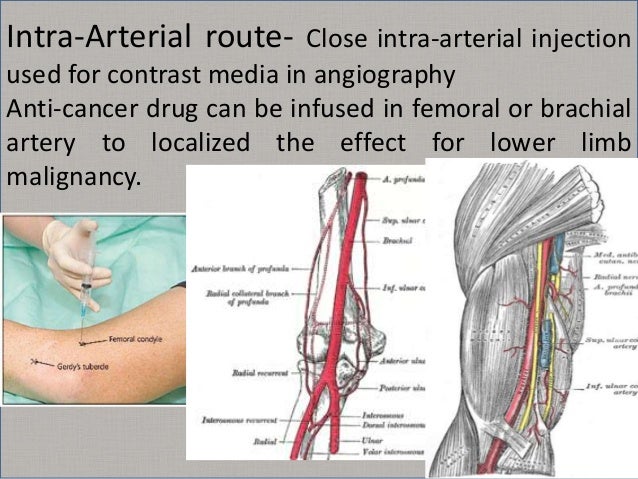Route of Drug Administration