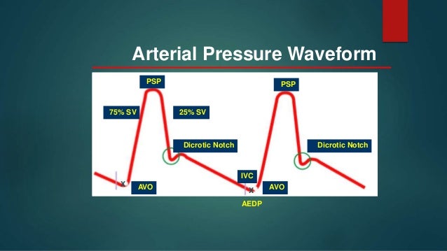 IABP when , why and how