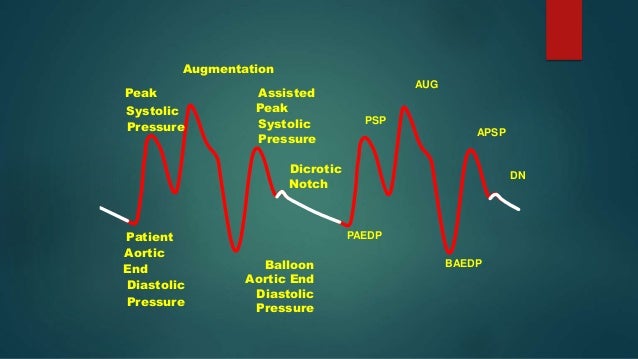 IABP when , why and how