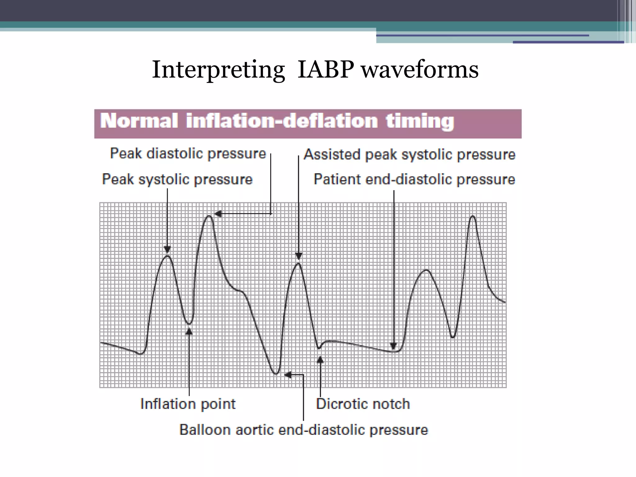 INTRA AORTIC BALLON PUMP (IABP) | PPT