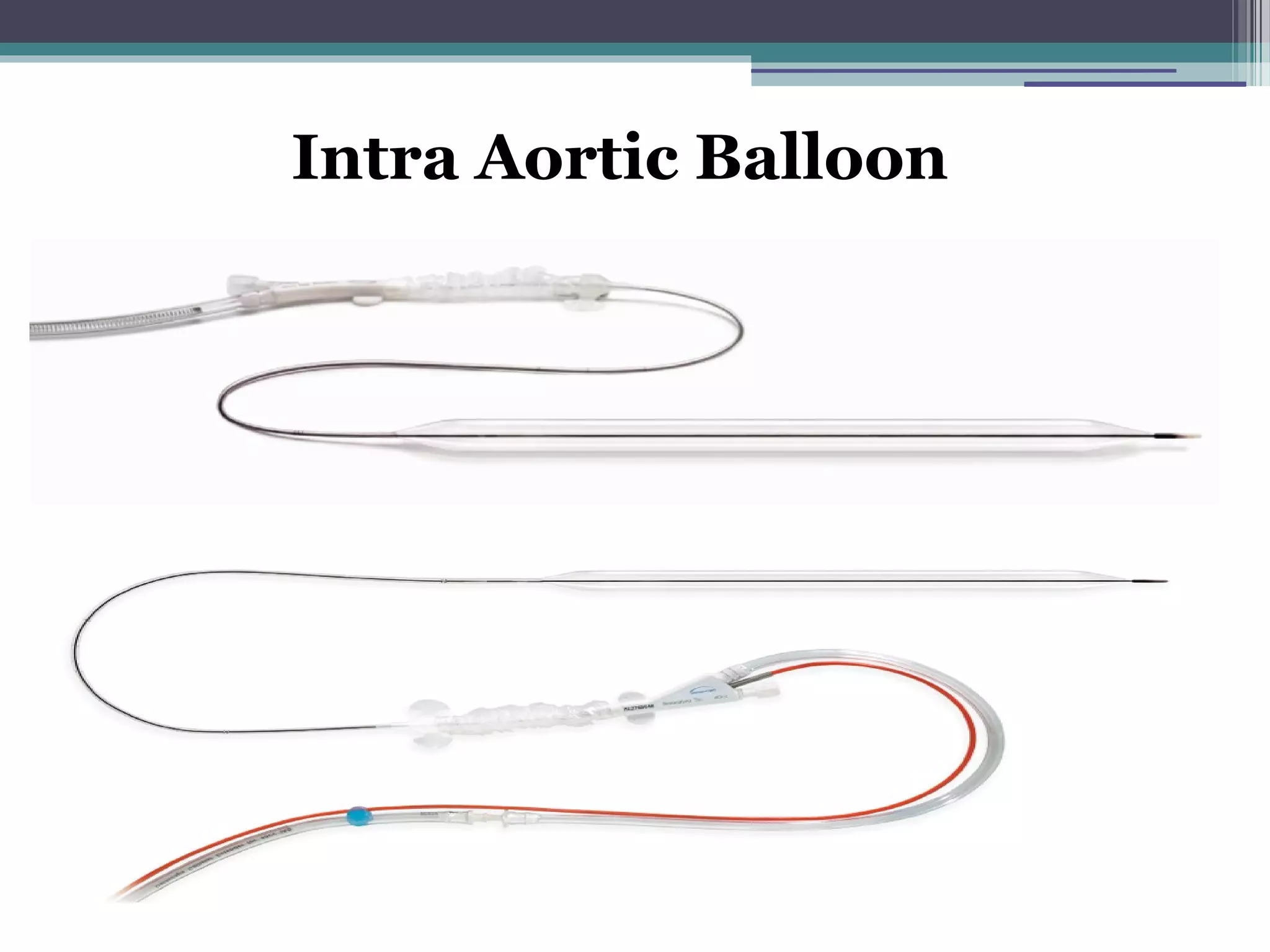 INTRA AORTIC BALLON PUMP (IABP) | PPT