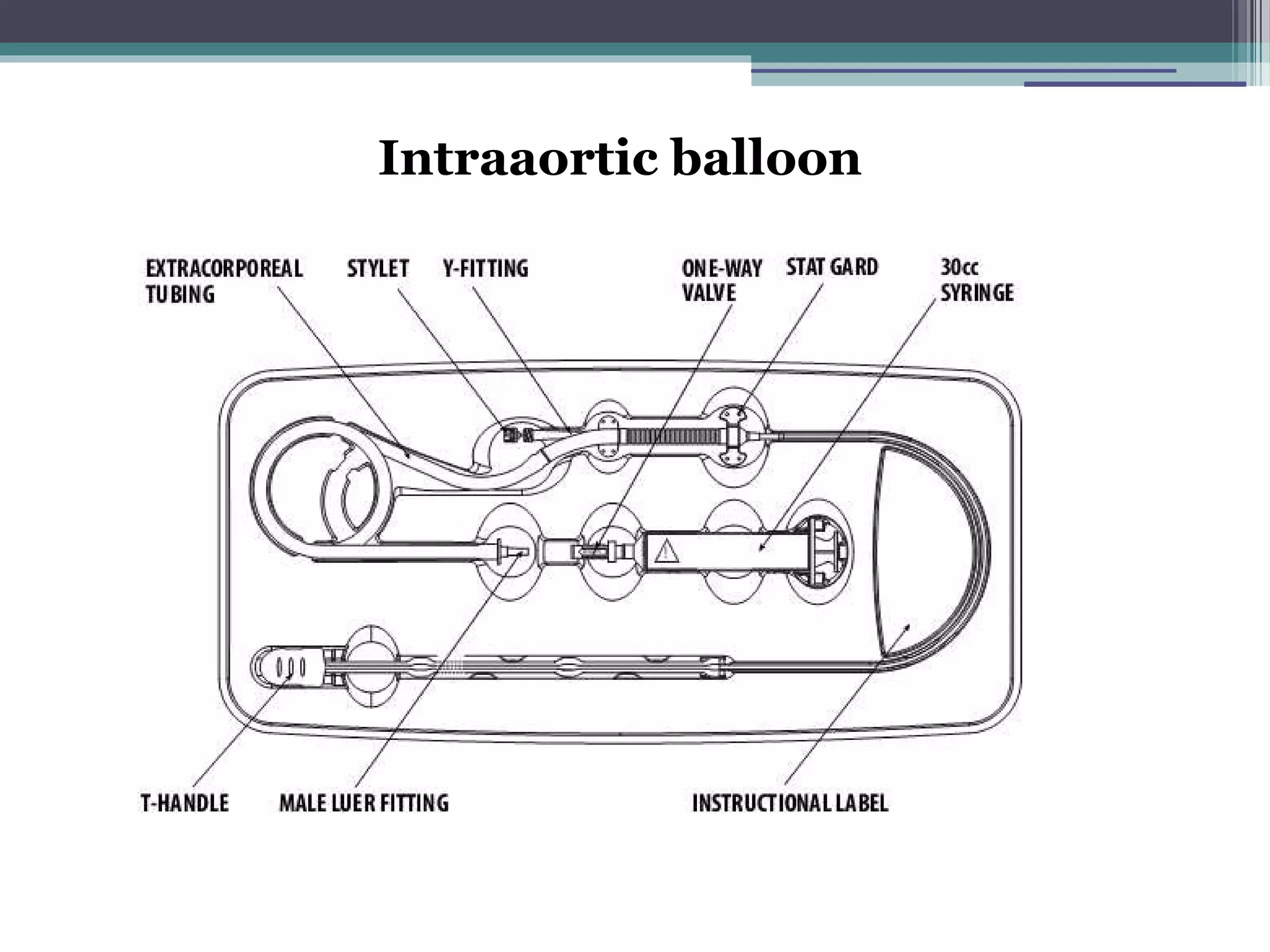 INTRA AORTIC BALLON PUMP (IABP) | PPT