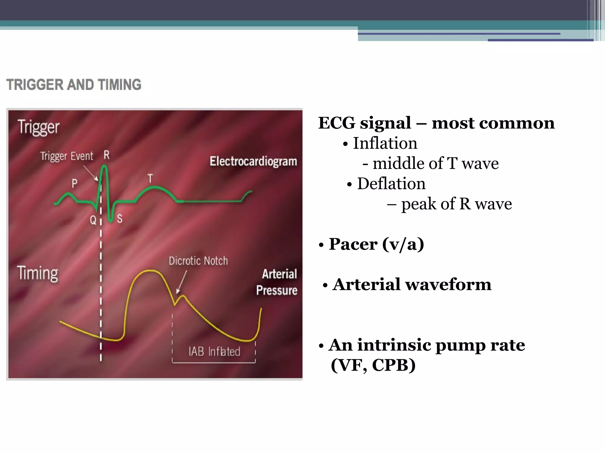 INTRA AORTIC BALLON PUMP (IABP) | PPT