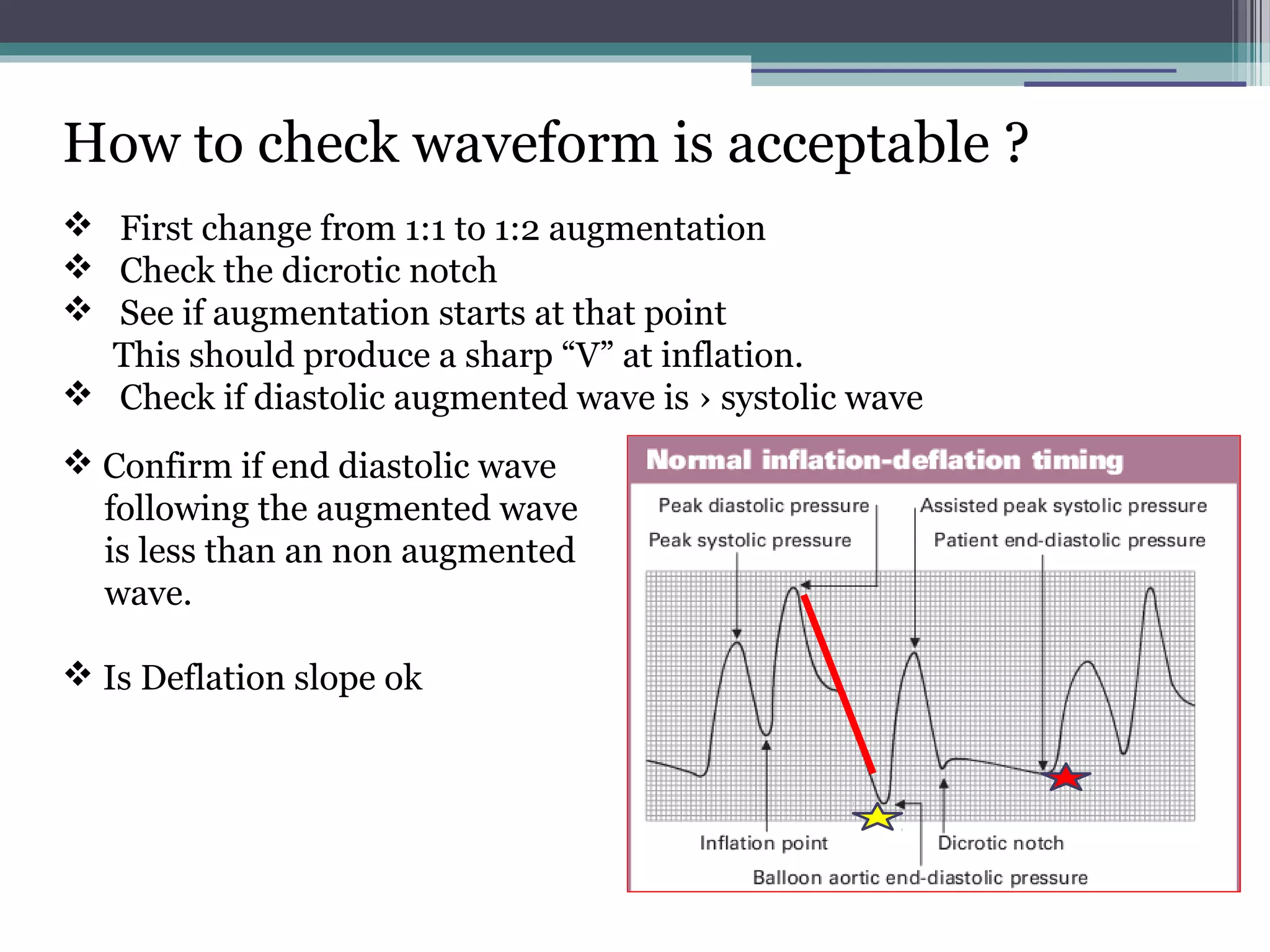 INTRA AORTIC BALLON PUMP (IABP) | PPT