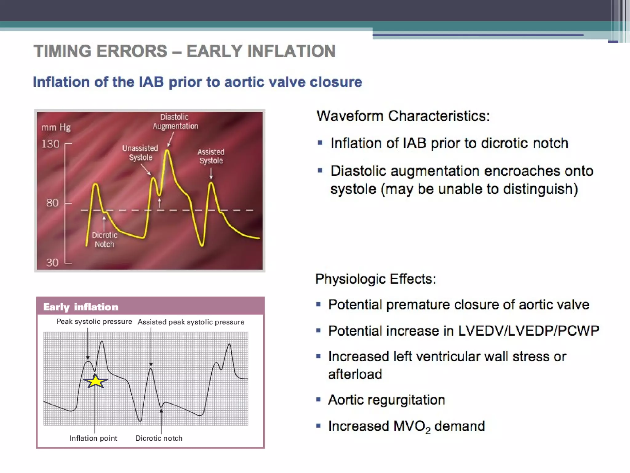 INTRA AORTIC BALLON PUMP (IABP) | PPT