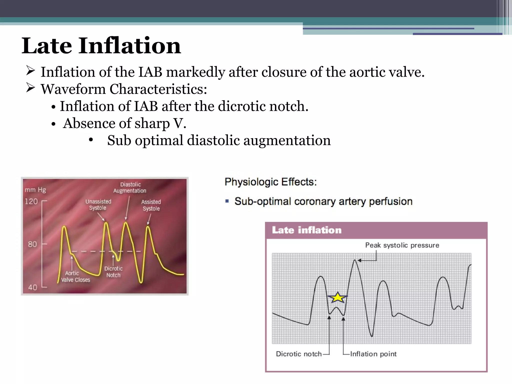 INTRA AORTIC BALLON PUMP (IABP) | PPT