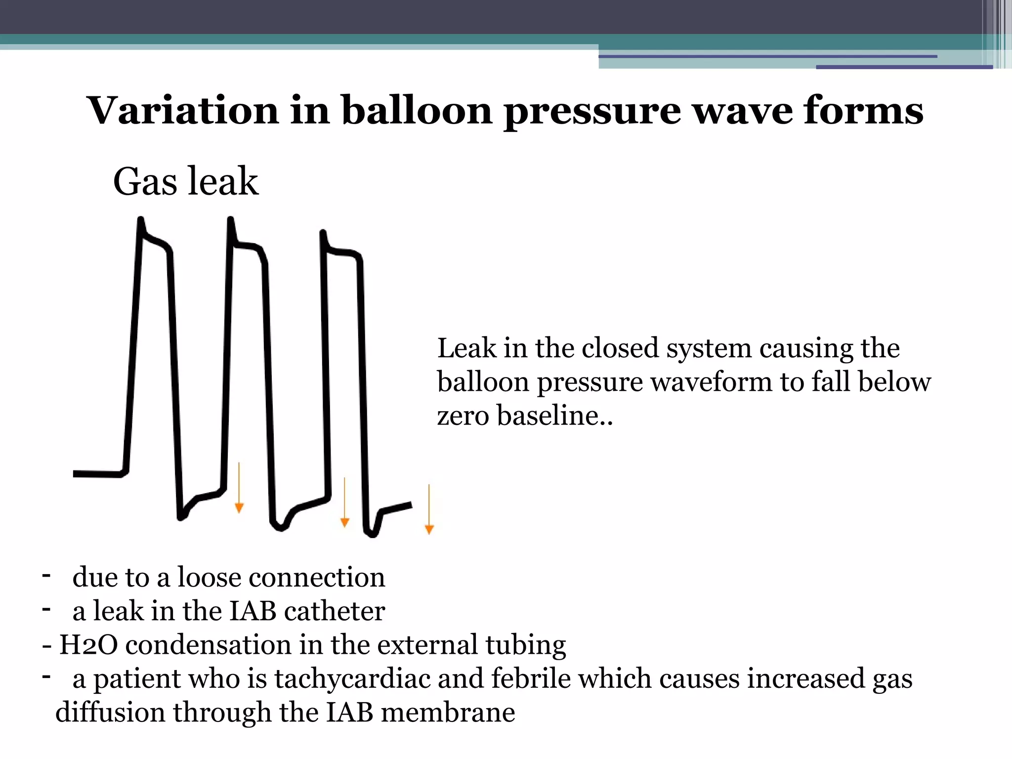 INTRA AORTIC BALLON PUMP (IABP) | PPT